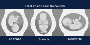How to Turn a Transverse Baby (and Avoid a C-Section)